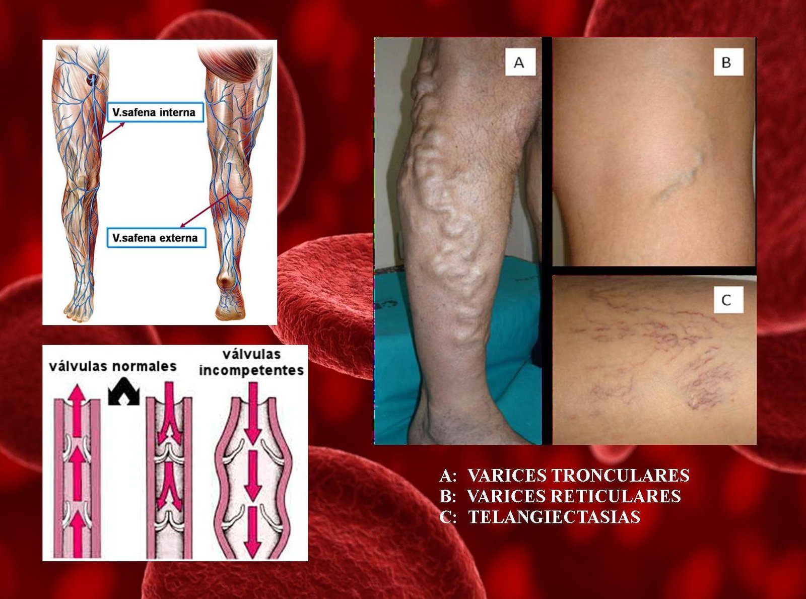 LAS VARICES: VÍAS EN MAL ESTADO - Granada Costa